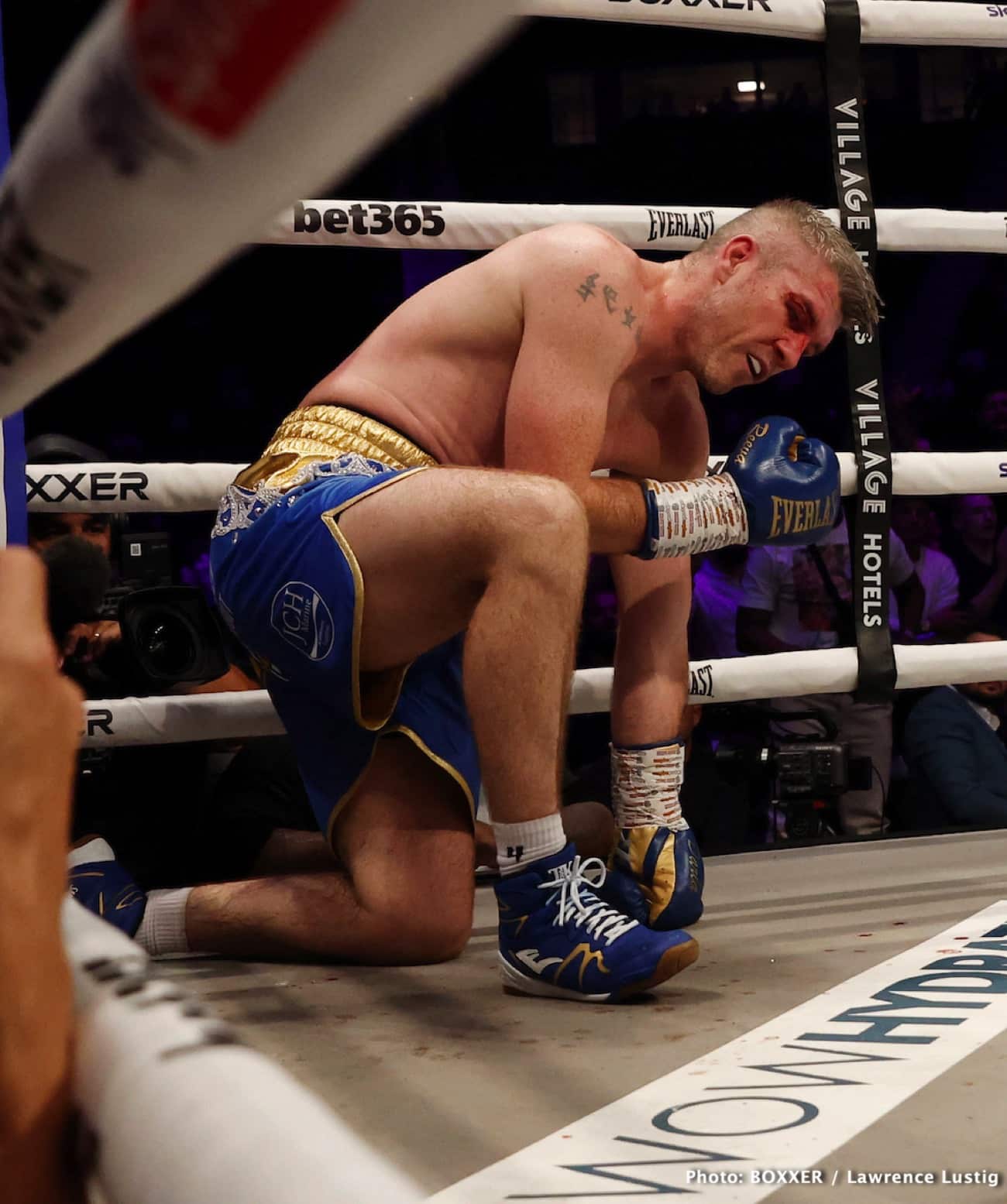 Liam Smith Says Cutting 42 Lbs Drained Him For Chris Eubank Jr. Fight ... Liam Smith Says Cutting 42 Lbs Drained Him For Chris Eubank Jr. Fight ...